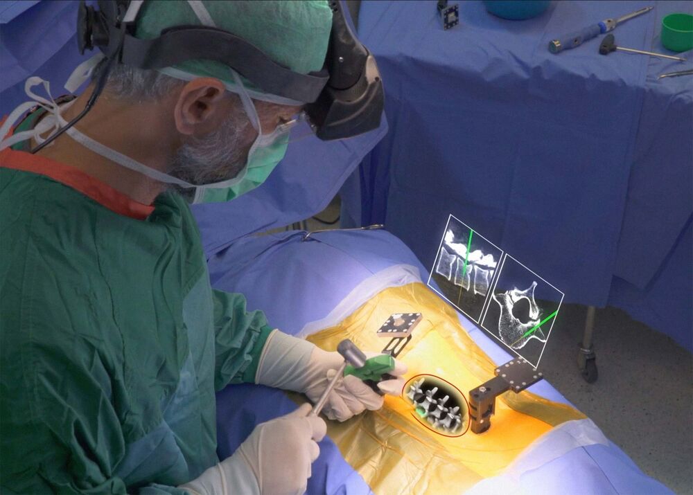 Israeli-Made Goggles Give Surgeons X-Ray Vision - JOY! News