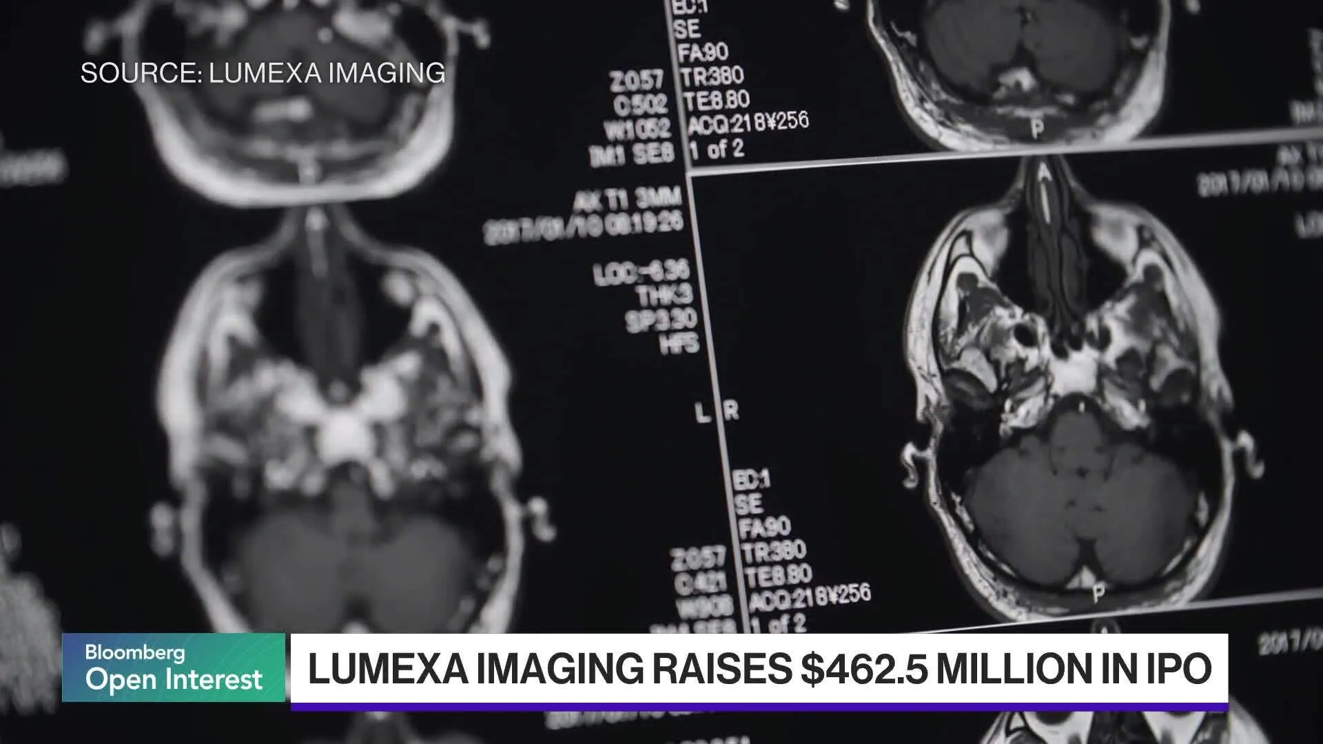 Watch Diagnostic Giant Lumexa Set for Nasdaq Launch - Bloomberg