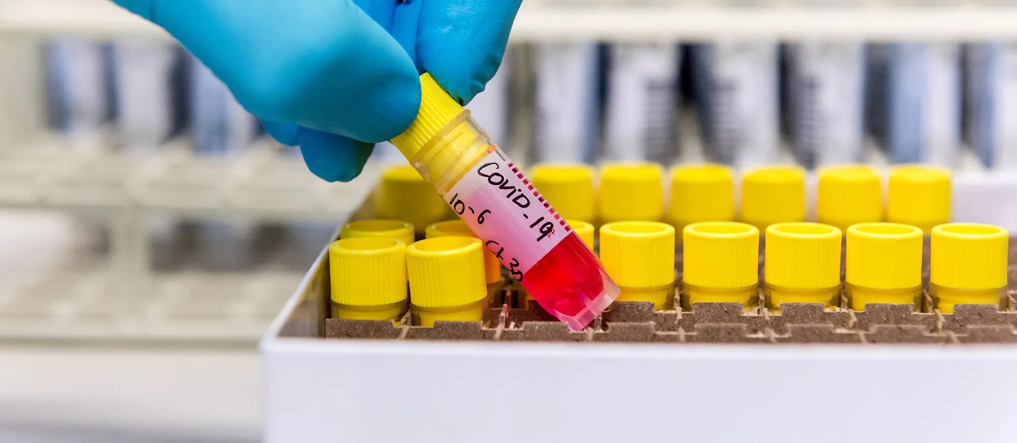 How Did Covid-19 Spread? Viral Genetics Leave Trail of Clues - Bloomberg