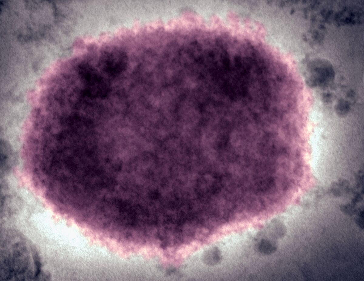 Conspiracy Theories That US May Be The Source of Monkeypox Virus Swirl ...