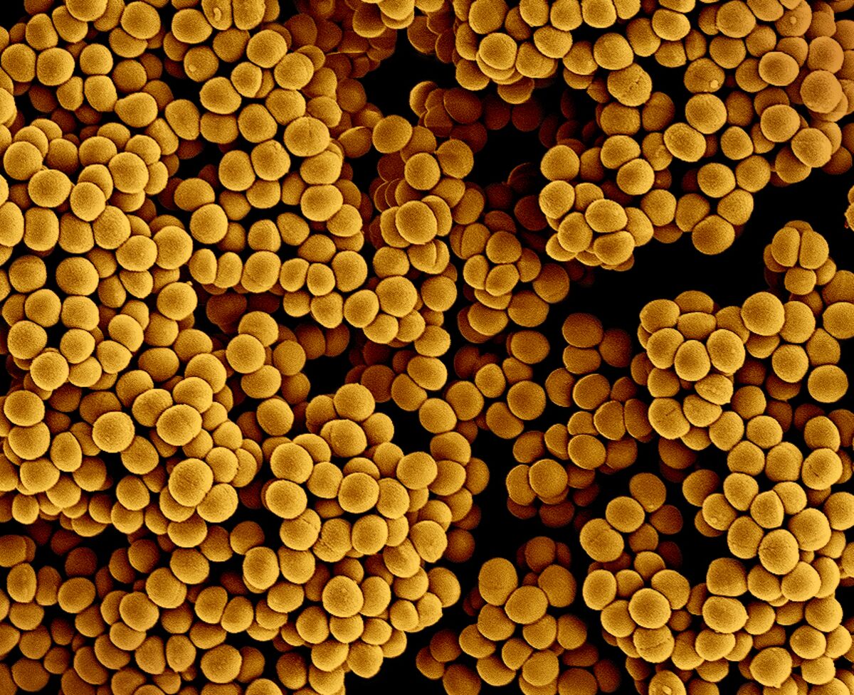 Diagnostic Tests Are Missing Link in Solving Superbug Deaths - Bloomberg
