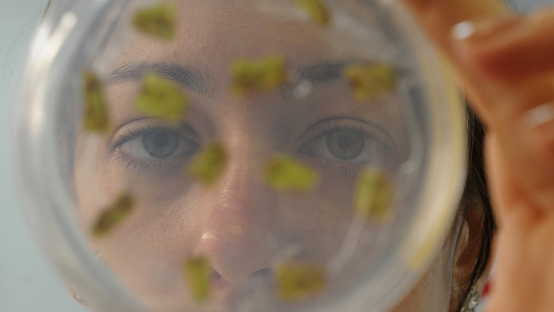 Watch The Human Microbiome: Why Some Germs Are Good For You - Bloomberg