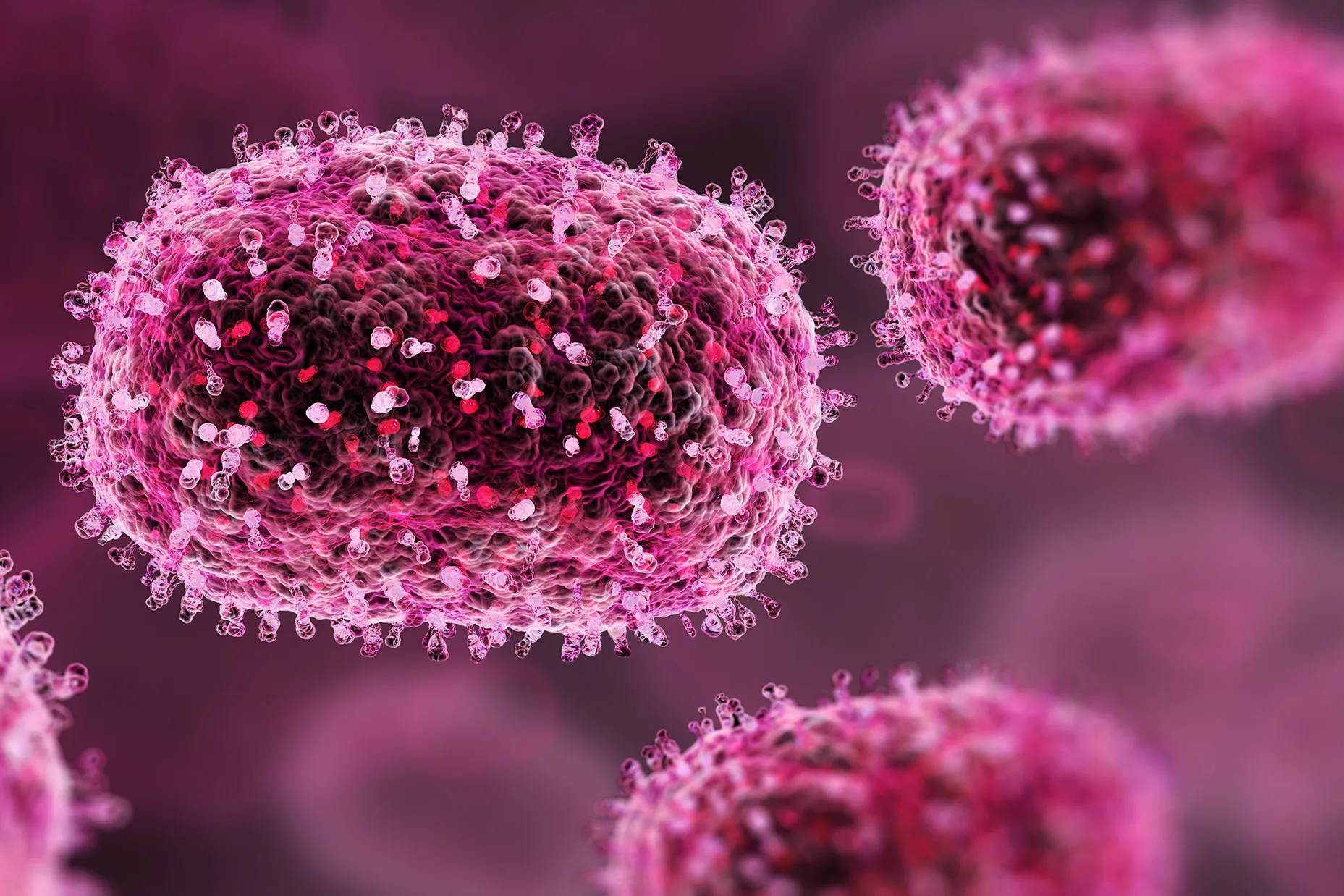 Mpox Latest: First US Case of New Variant Confirmed in California ...