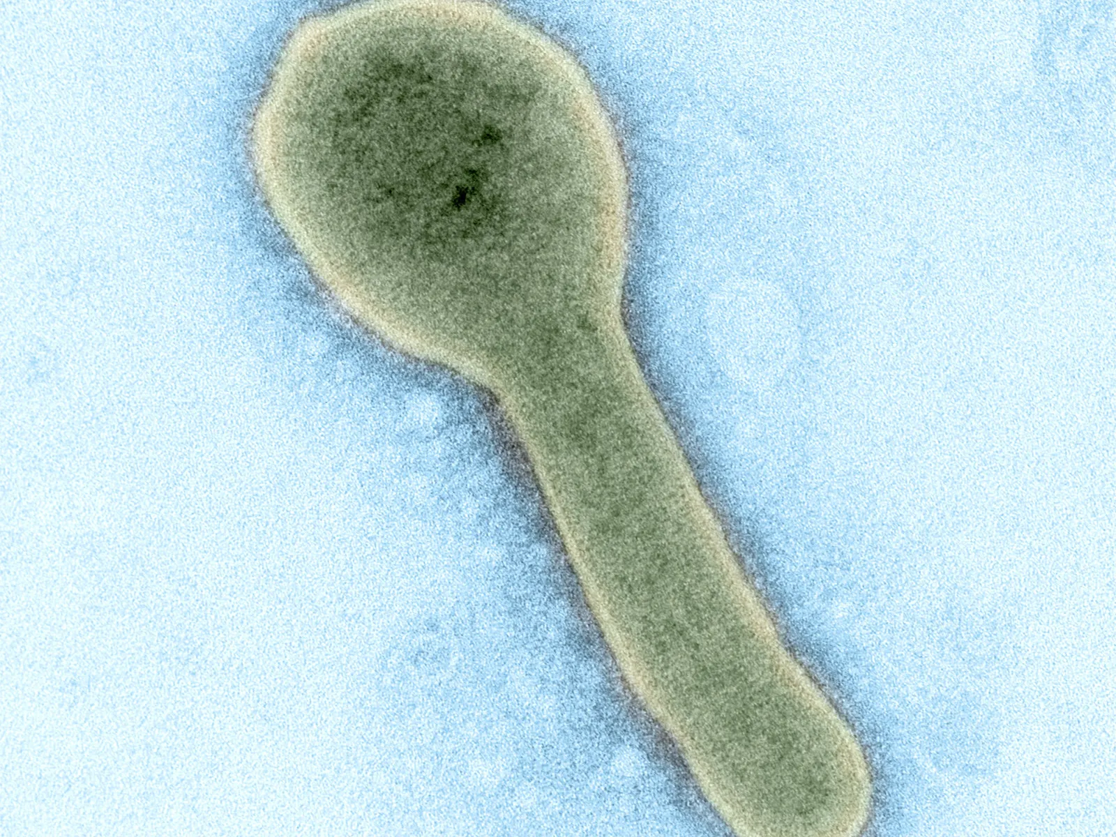 Marburg Virus: Ghana Declares First Disease Outbreak - Bloomberg