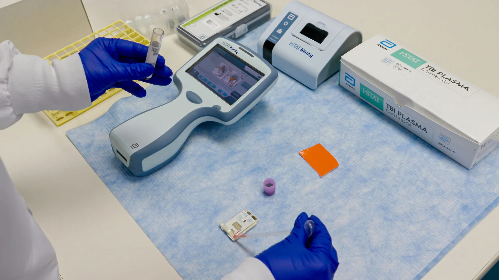 Concussion Test Gives Results in 15 Minutes With Blood Sample - Bloomberg