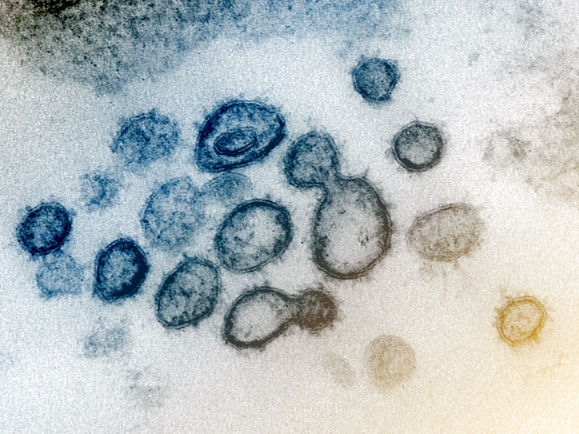 How to Stay Ahead of a Mutating Virus - Bloomberg