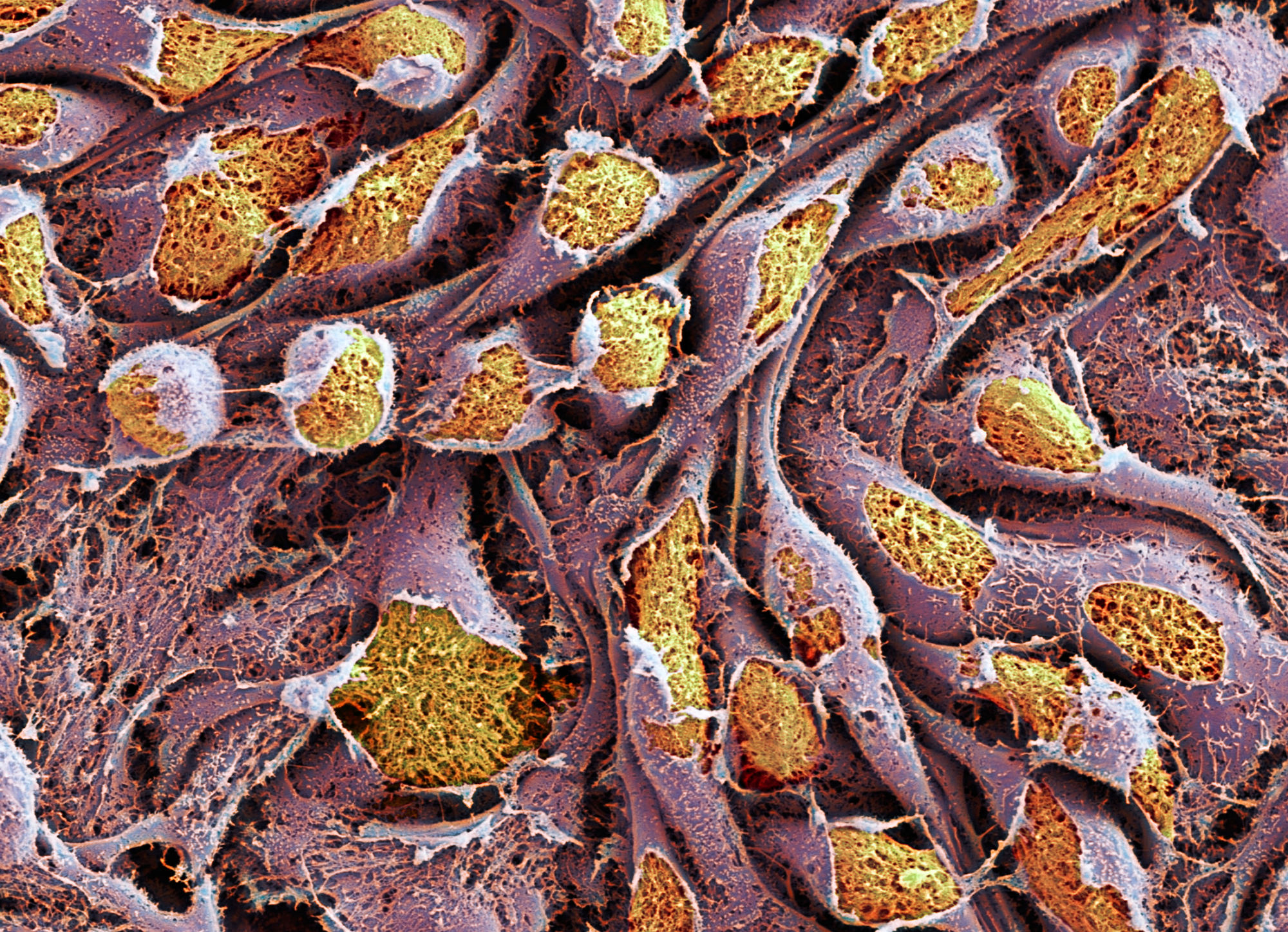 Stem Cells May Be Next Frontier for Diabetes Drugmaker Novo - Bloomberg