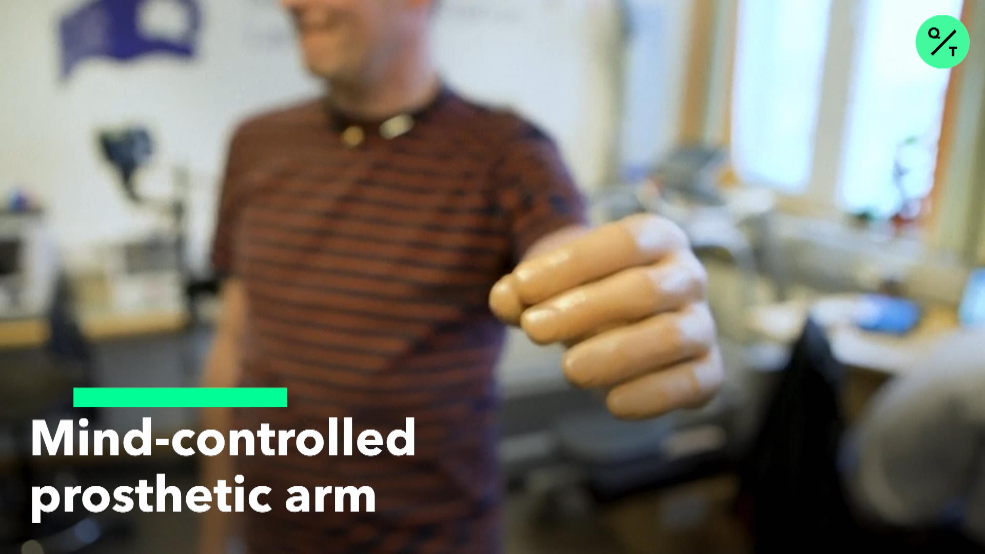 Watch Mind-controlled Prosthetic Limbs - Bloomberg