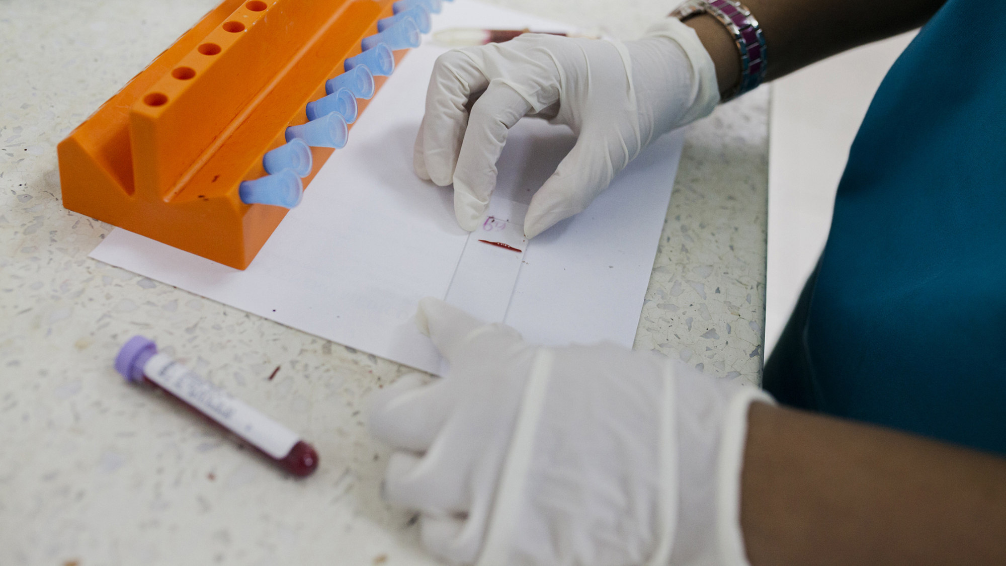 Theranos Tests Aren't as Reliable as Standard Ones, Study Finds - Bloomberg