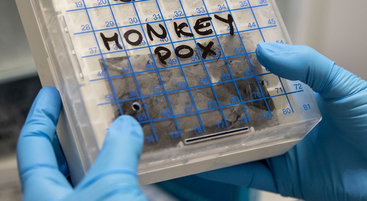 Philippines Detects First Monkeypox Case, Health Department Says ...