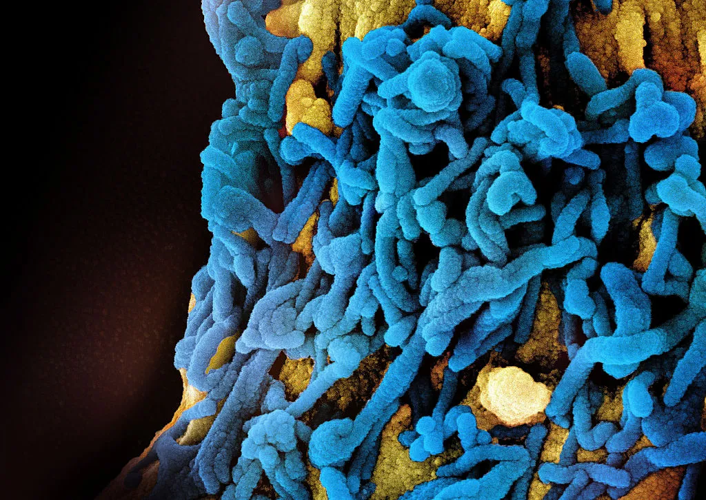 Ethiopia Confirms First Outbreak of Marburg Virus After Testing - Bloomberg